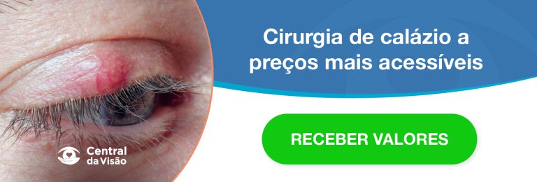 Tudo o que você precisa saber sobre calázio